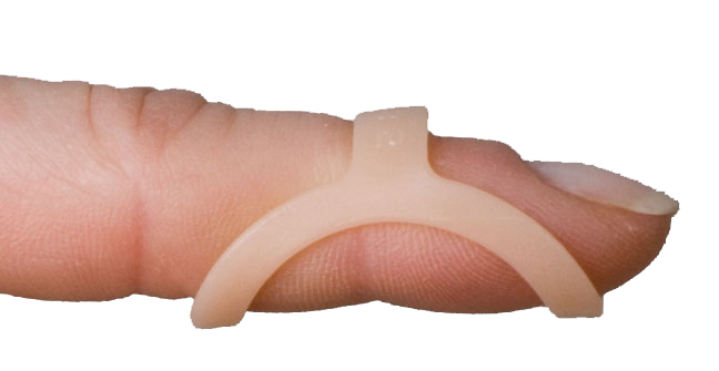 Mallet Finger - A Clinical Protocol